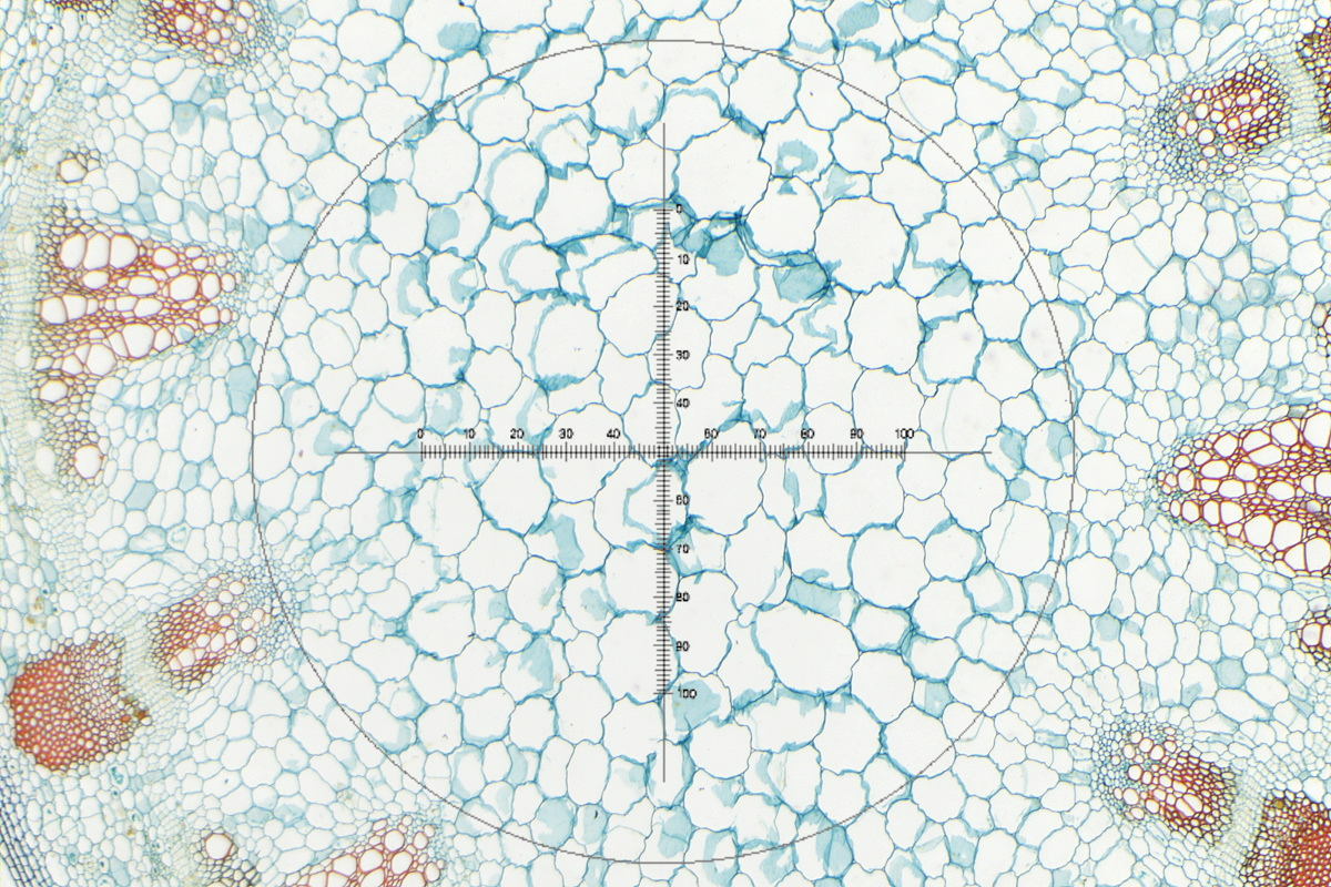 顕微鏡でのサイズ計測（接眼ミクロメーターを使用する方法） | WRAYMER顕微鏡 テクニカルサポート