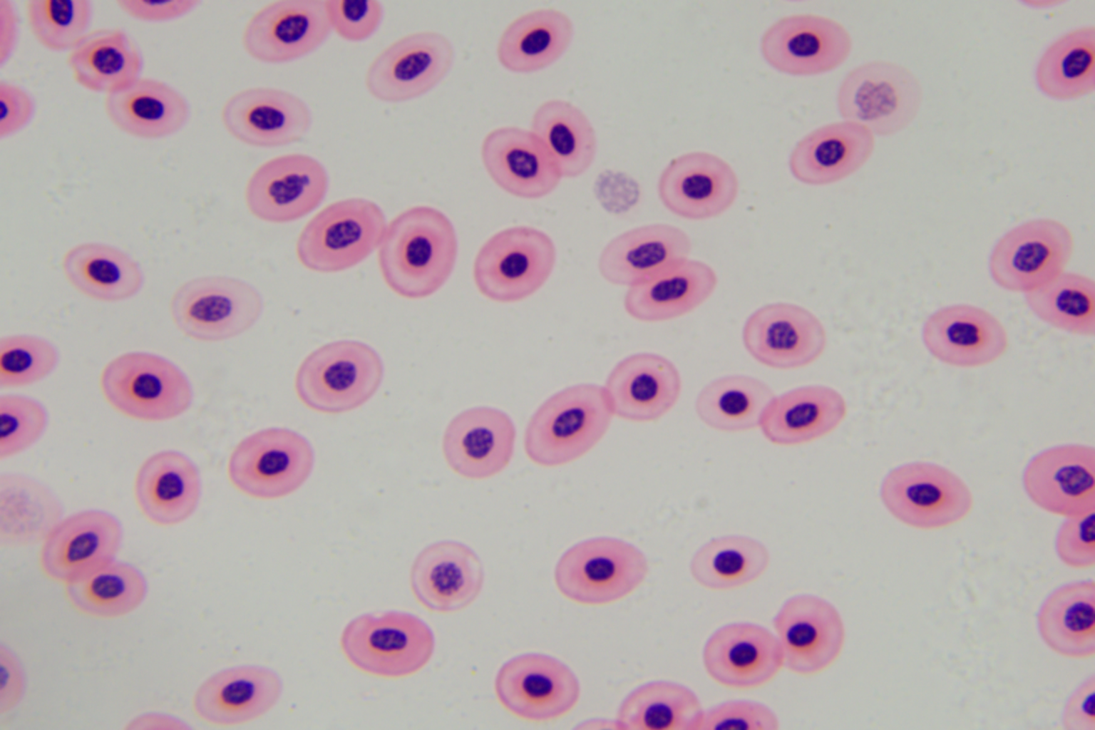 露出時間とゲインについて | WRAYMER顕微鏡 テクニカルサポート